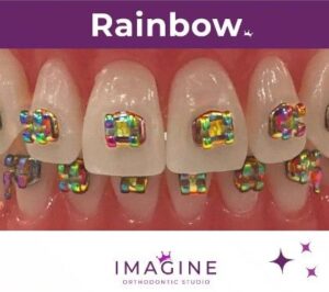 What Makes Us Different - Imagine Orthodontic Studio